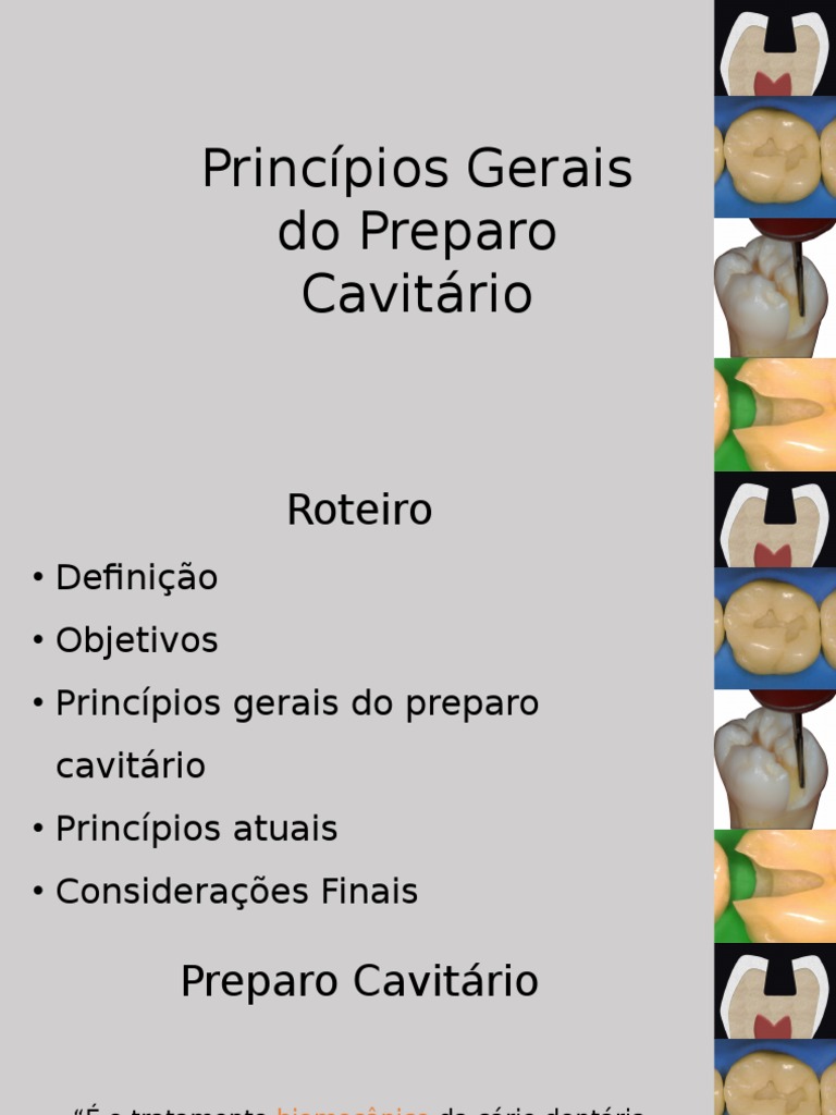 Princípios Gerais Do Preparo Cavitário | PDF | Anatomia animal | Áreas ...