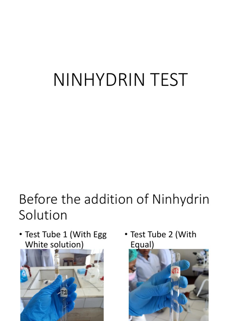 NINHYDRIN TEST-WPS Office | PDF