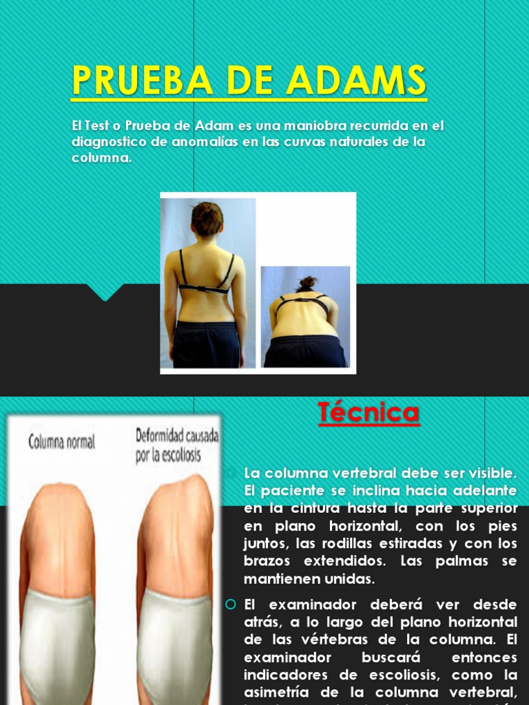 Prueba de Adams para Escoliosis | PDF | La columna vertebral | Escoliosis