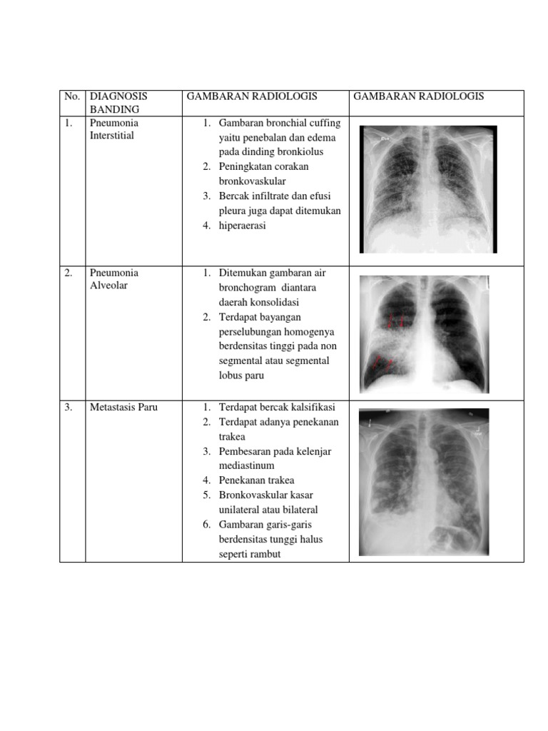 Gambaran Radiologis Pada Berbagai Gangguan Paru | PDF