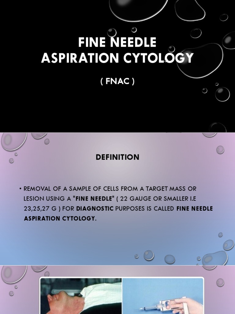 Fine Needle Aspiration Cytology EDITED | PDF | Biopsy | Cytopathology