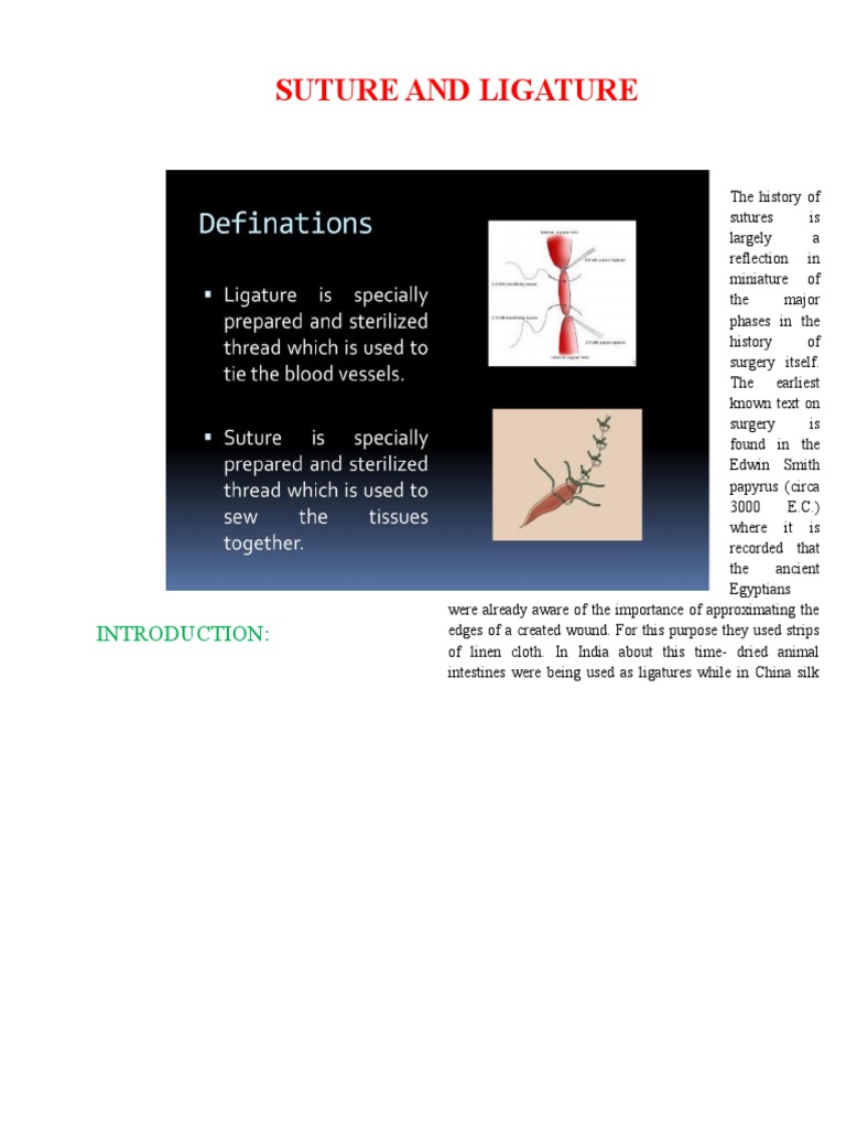 A Discussion On Suture and Ligature | PDF | Surgical Suture | Fibers