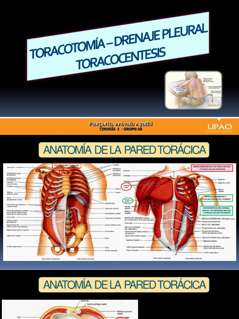 Toracotomia y Drenaje Pleural - Cirugía 1 | Tórax | Tórax (anatomía humana)