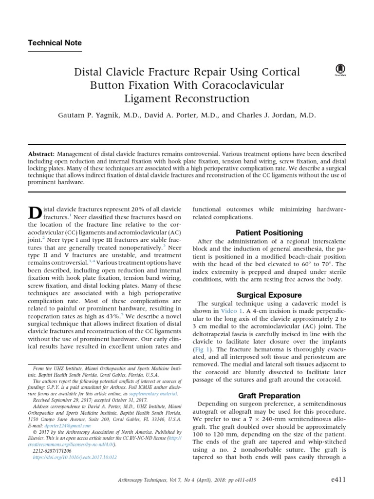 Distal Clavicle Fracture Repair Using Cortical But | PDF | Anatomical ...
