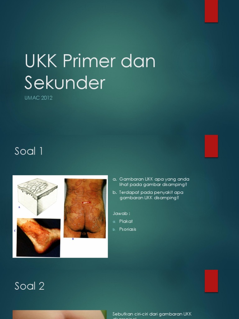 LBM 1 Contoh Soal UKK 1 (SKILL) | PDF | Sains & Matematika
