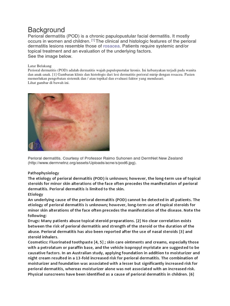 Perioral Dermatitis | PDF | Medical Specialties | Drugs