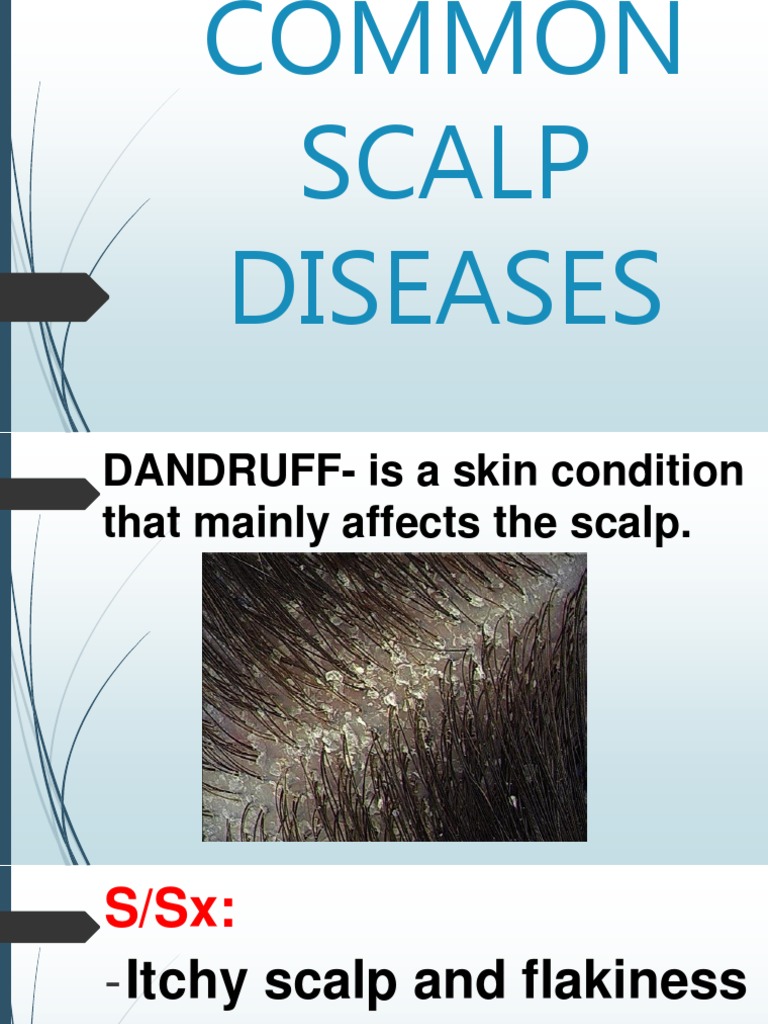 Common Scalp Diseases | PDF
