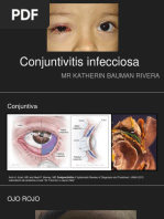 GPC #06 - CONJUNTIVITIS AGUDA - Feb 2022 | PDF | Alergia | Enfermedades ...