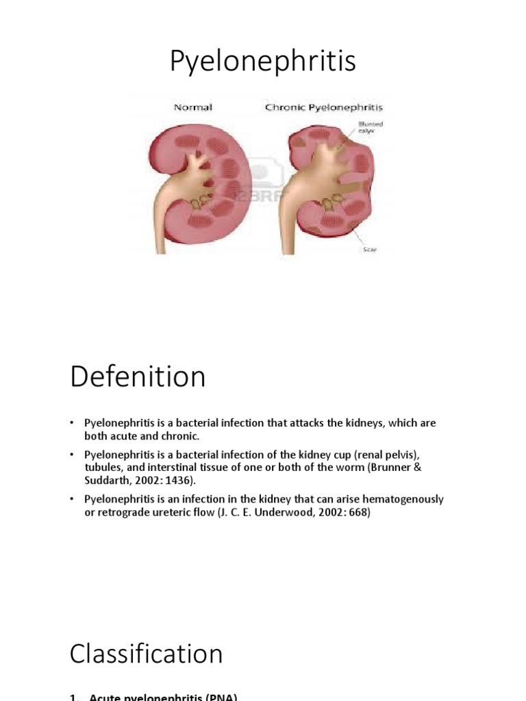 Pyelonephritis | PDF | Kidney | Urinary Tract Infection