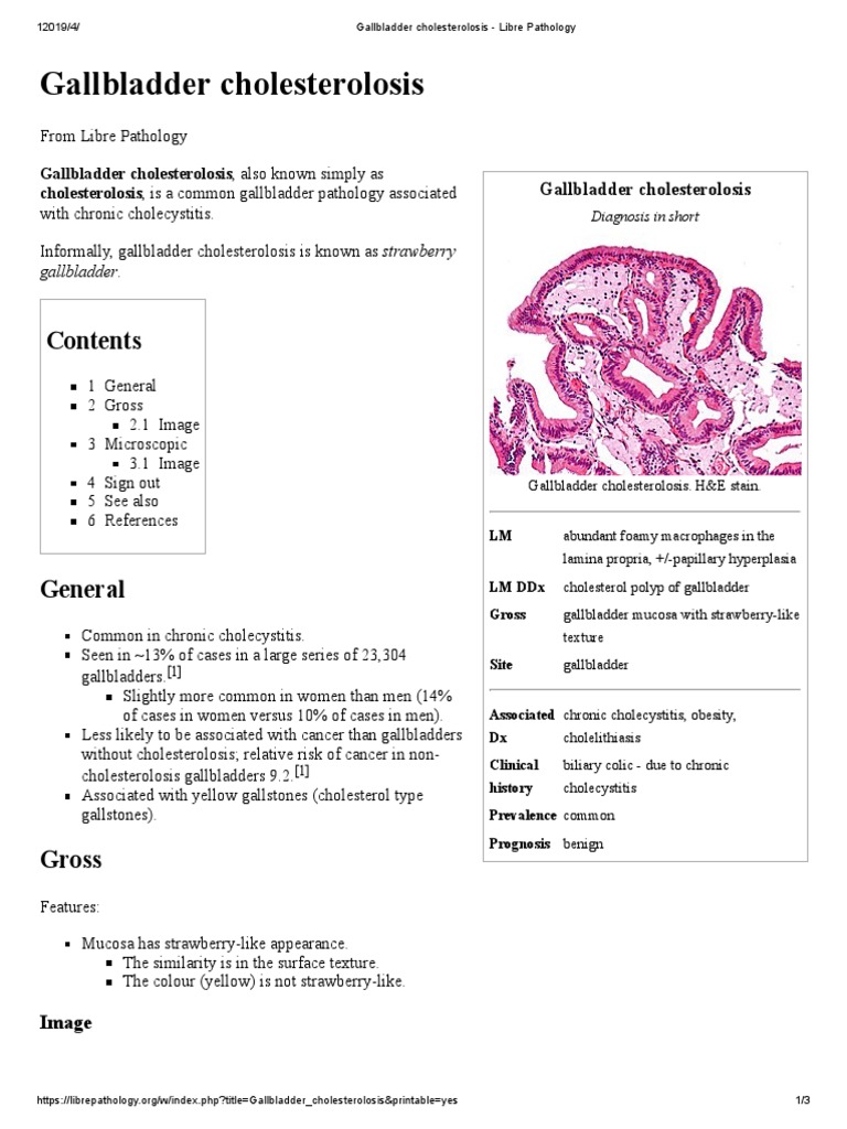 Gallbladder cholesterolosis | Gallbladder | Liver