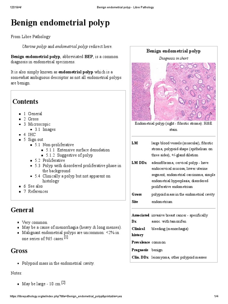 Benign Endometrial Polyp Overview | PDF | Pathology | Mammal Female ...
