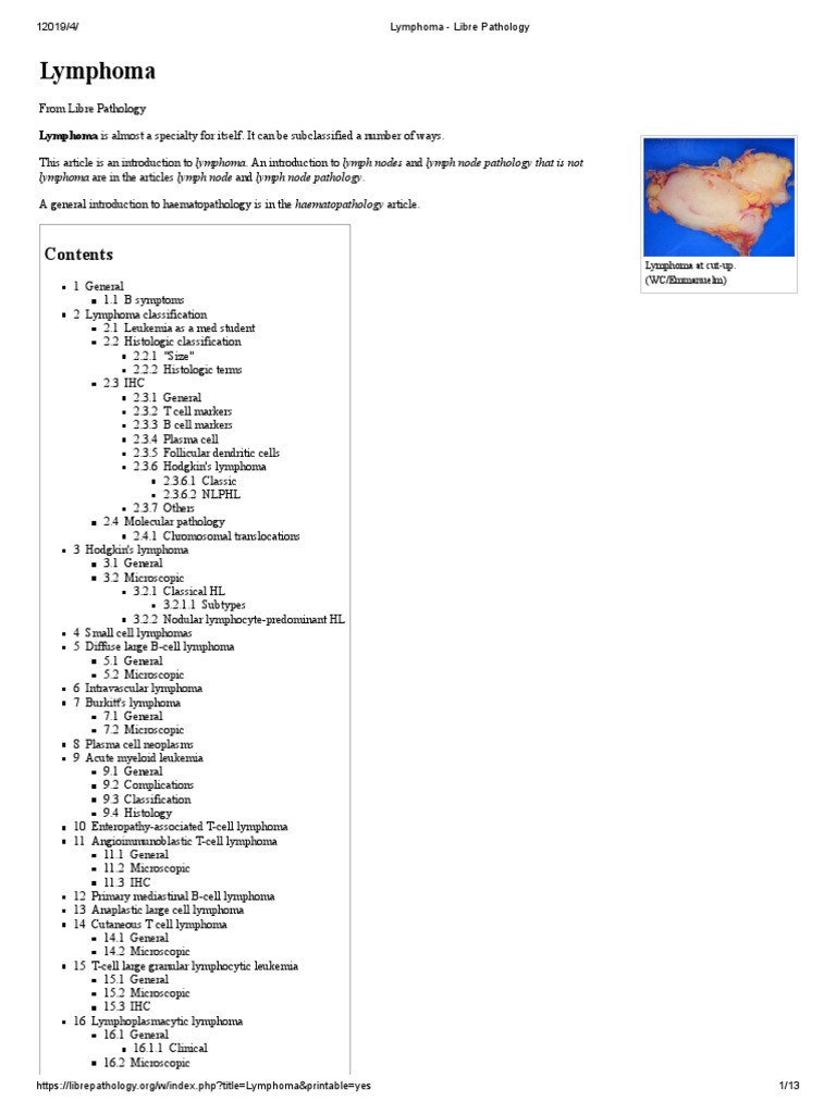 18 Lymphoma - Libre Pathology | PDF | Lymphoma | Lymphatic System