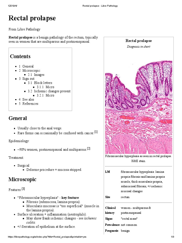 Rectal Prolapse: Diagnosis and Pathology | PDF | Rectum | Medicine