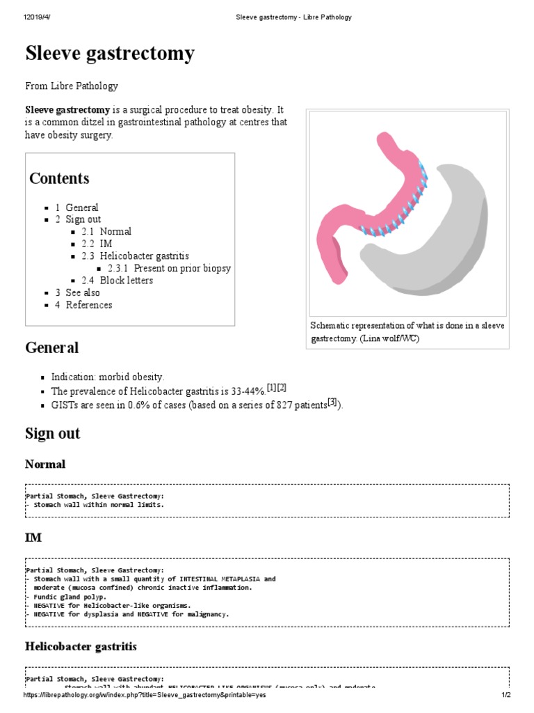 14 Sleeve Gastrectomy - Libre Pathology | PDF | Stomach | Surgical ...