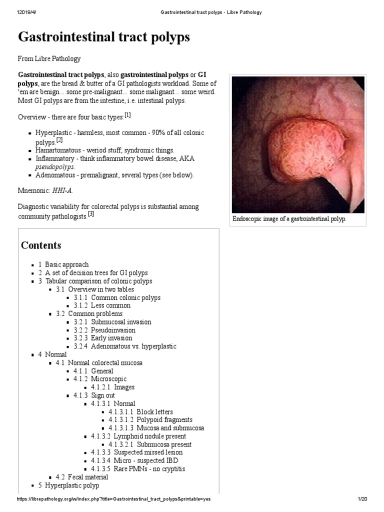 GI Polyps: Types and Pathology Overview | PDF | Adenoma | Colorectal Cancer