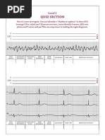 ACLS Post Test Answer Key 2024 | PDF | Cardiopulmonary Resuscitation ...