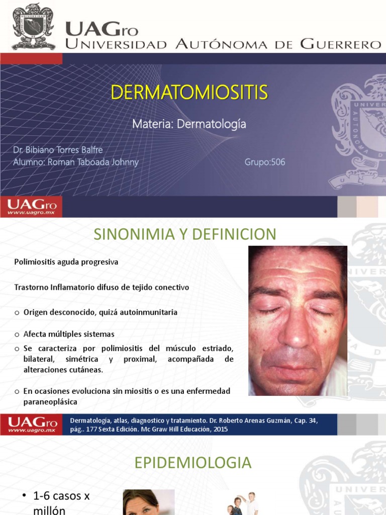 Dermatomiositis | PDF | Inmunología | Ciencias de la Salud