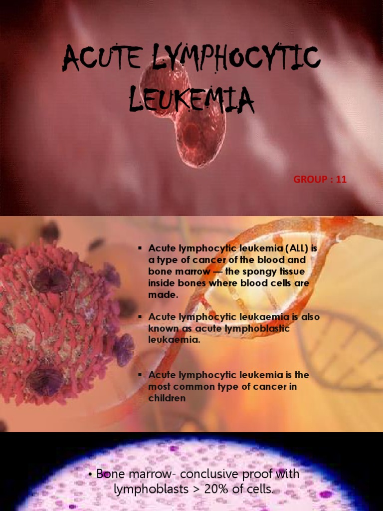 Acute Lymphocytic Leukemia | PDF | Leukemia | Bone Marrow