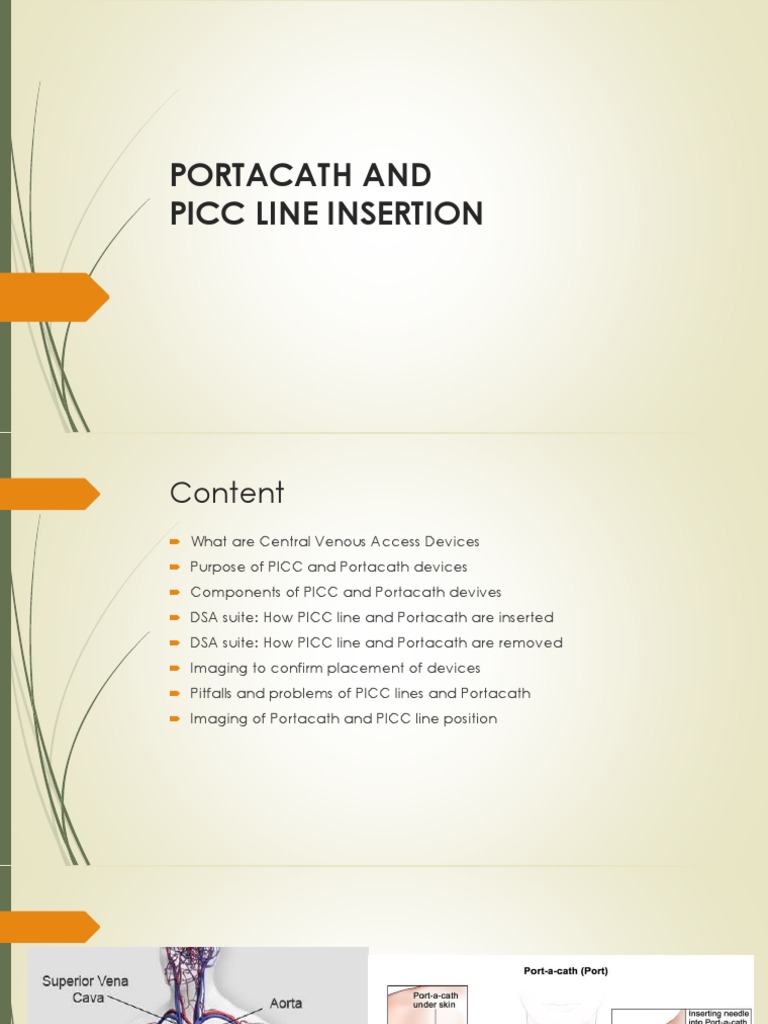 PICC Line and Portacath Guide | PDF | Business | Computers