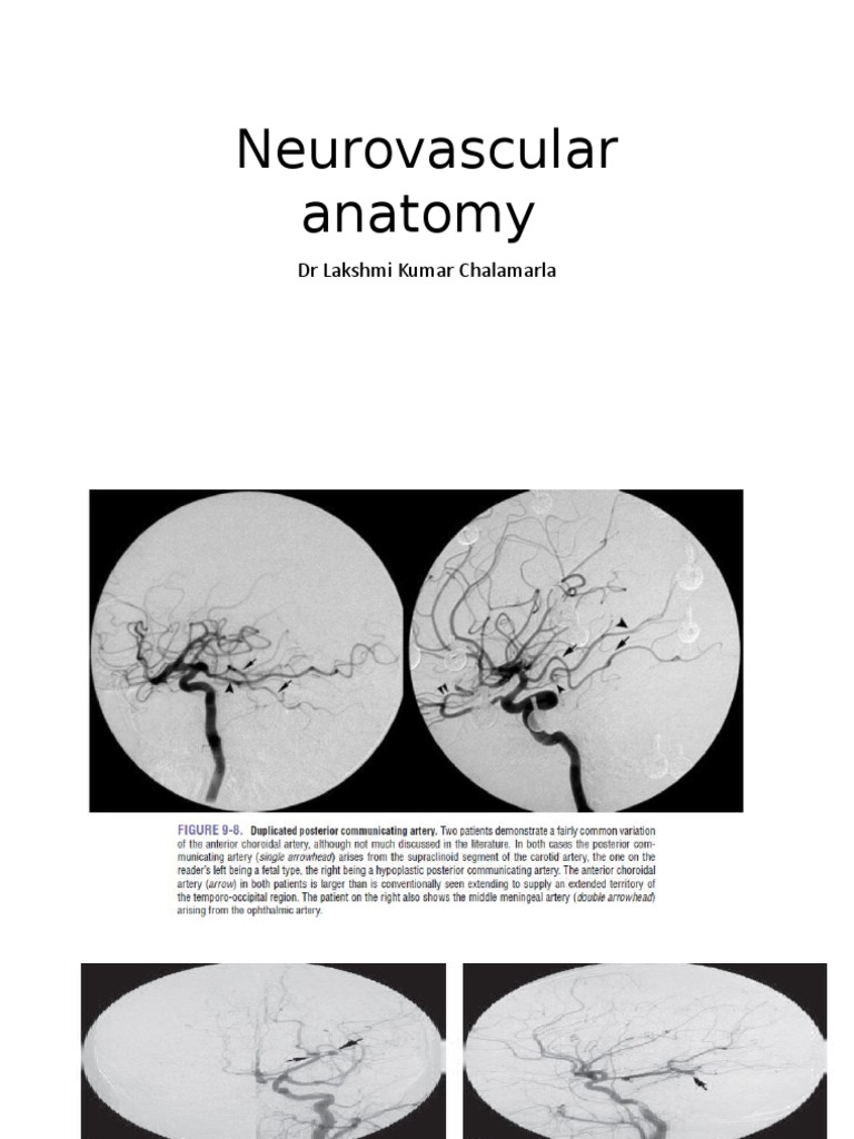 Neurovascular Anatomy Overview | PDF