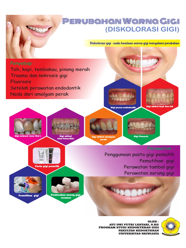 Poster Diskolorasi Gigi | PDF
