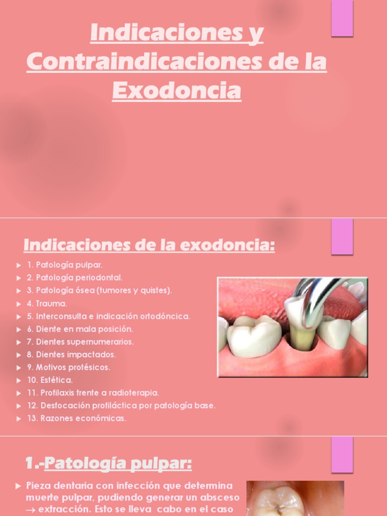 Indicaciones y Contraindicaciones en La Exodoncia | PDF | Lesión | Diente