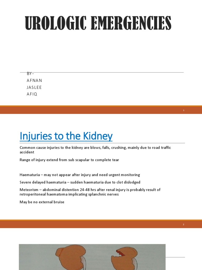 Urologic Emergencies: BY-Afnan Jaslee Afiq | Download Free PDF ...