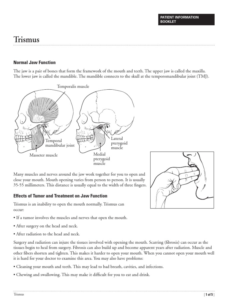 Trismus: Normal Jaw Function | PDF | Medicine | Human Anatomy