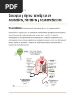 Signos Radiológicos Neumoperitoneo | PDF