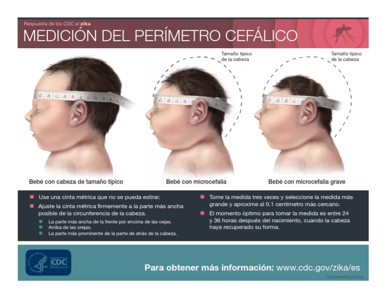 7b.microcephaly Measuring Esp