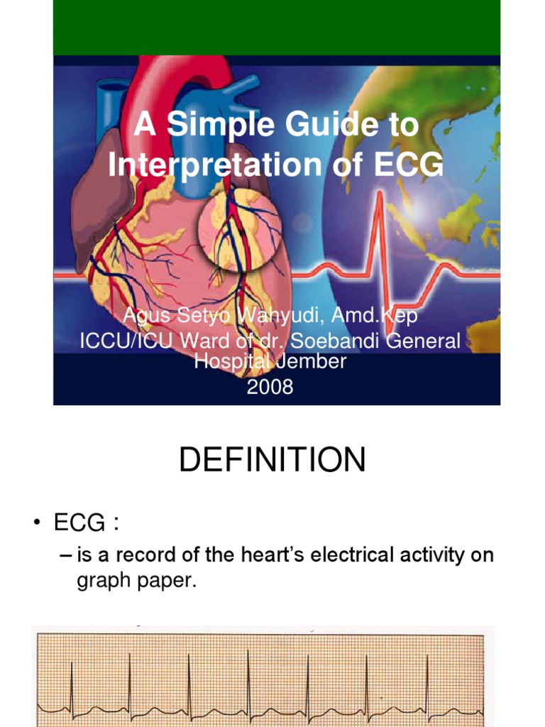 Simple Guide To Ecg Interpretation | PDF | Electrocardiography ...