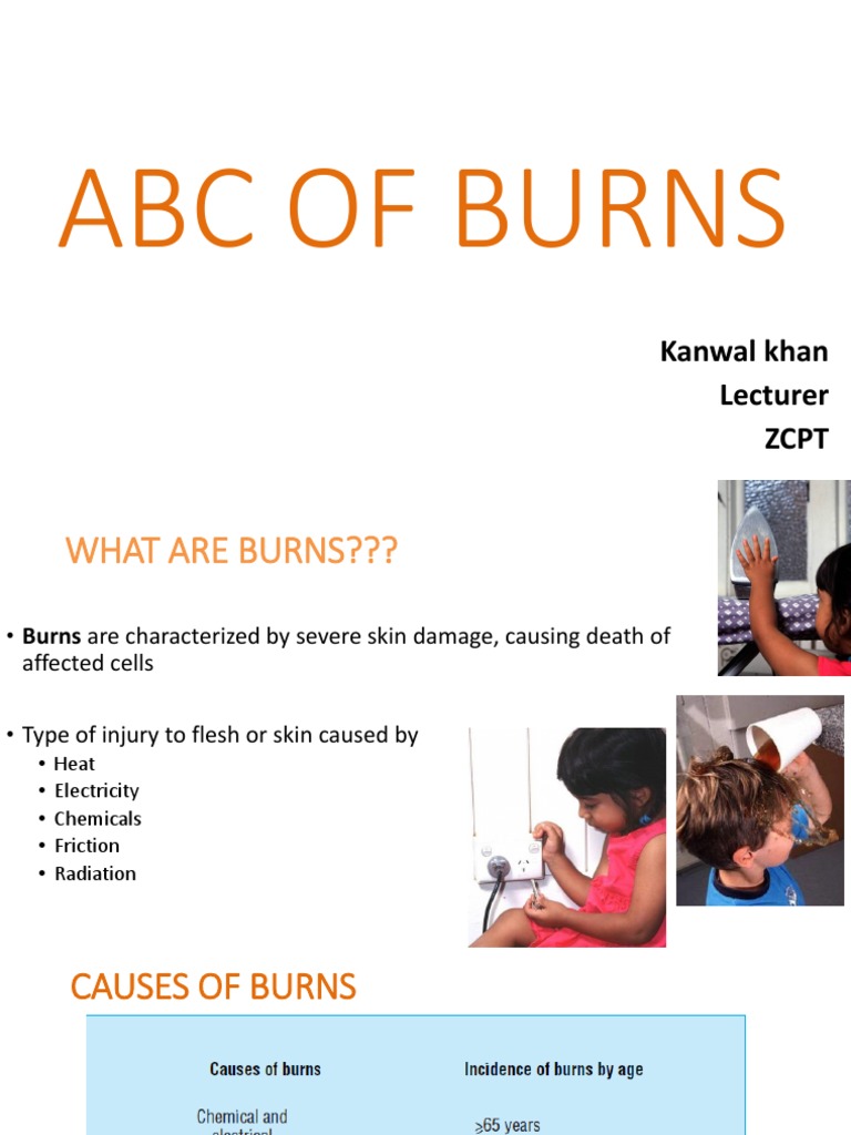 Abc of Burns: Kanwal Khan Lecturer ZCPT | PDF | Burn | Wound