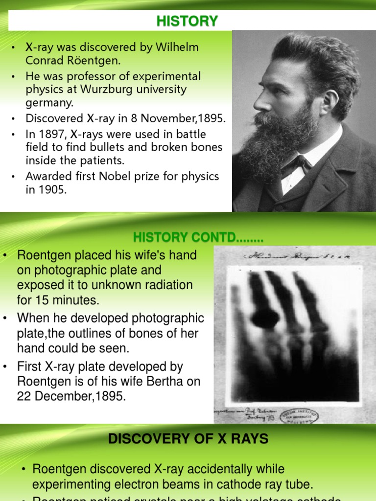 Discovery of X-Rays: A Comprehensive History of Wilhelm Röentgen's ...