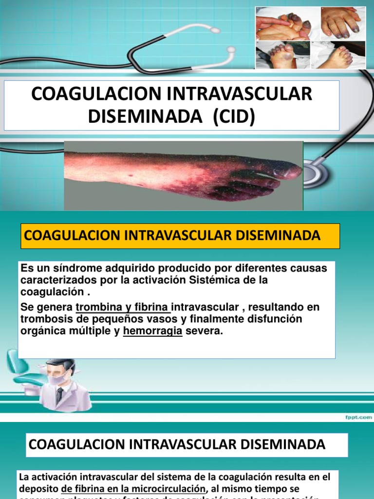 Coagulacion Intravascular Diseminada (Cid) Expo | PDF | Coagulación ...