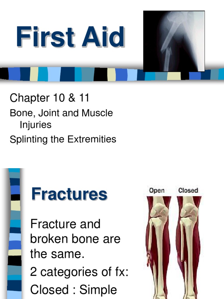 First Aid For Fractures And Sprains