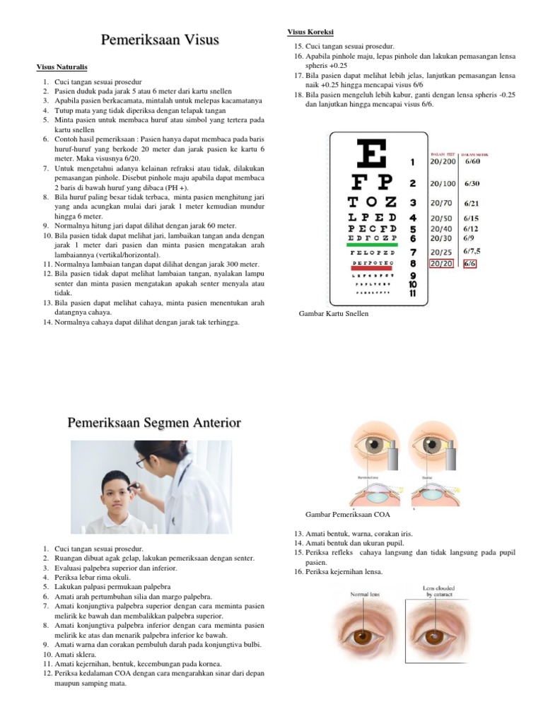 Panduan Pemeriksaan Mata Lengkap | PDF