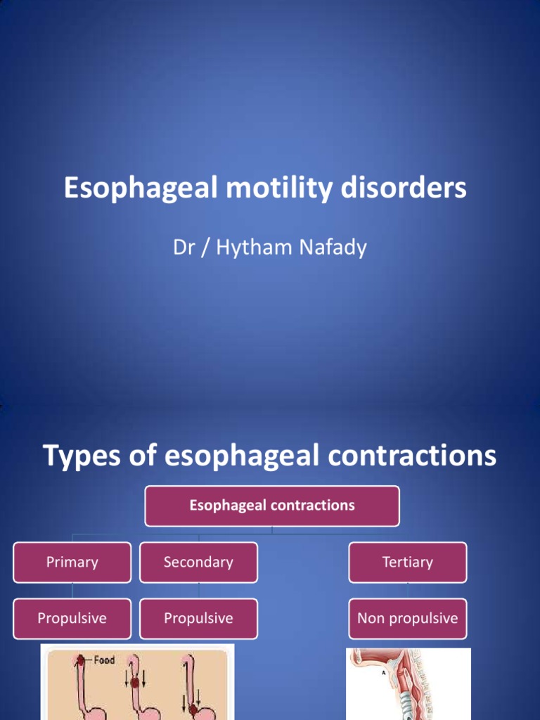 Esophageal Motility Disorders: DR / Hytham Nafady | PDF | Esophagus ...