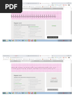 Pre-Evaluacion SVCA ACLS AHA 2015 Con Los Trazados Del EKG y Respuestas ...