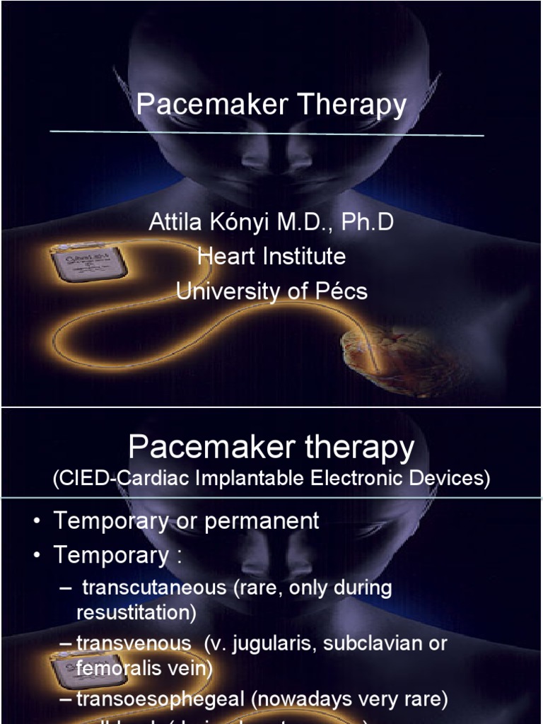 Pacemaker Therapy: Attila Kónyi M.D., PH.D Heart Institute University ...