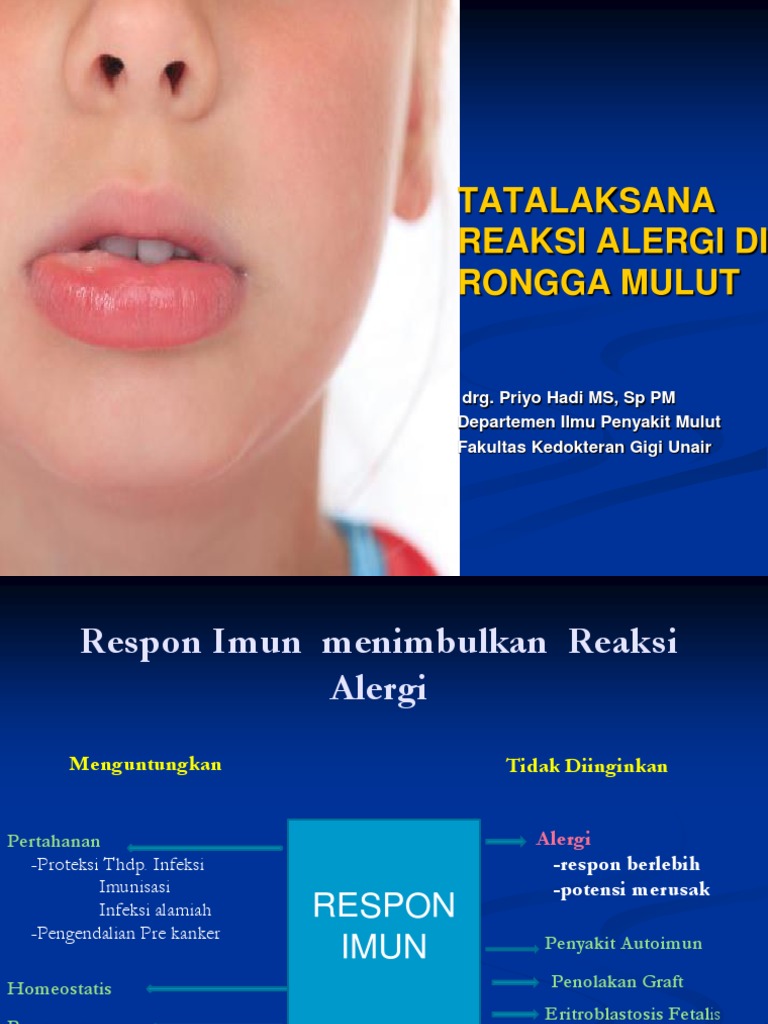 Reaksi Alergi di Rongga Mulut: Tipe dan Penanganan | PDF