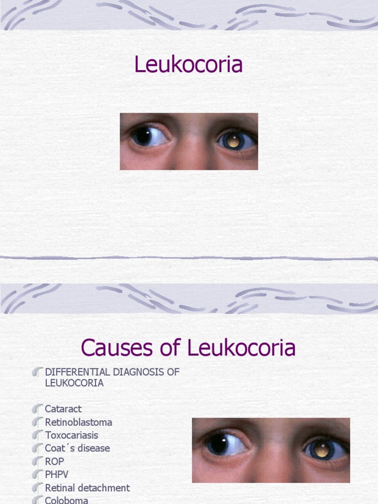 Leukocoria