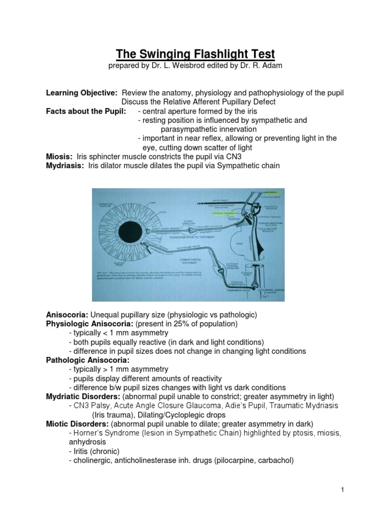 The Swinging Flashlight Test: Learning Objective: Facts About The Pupil ...