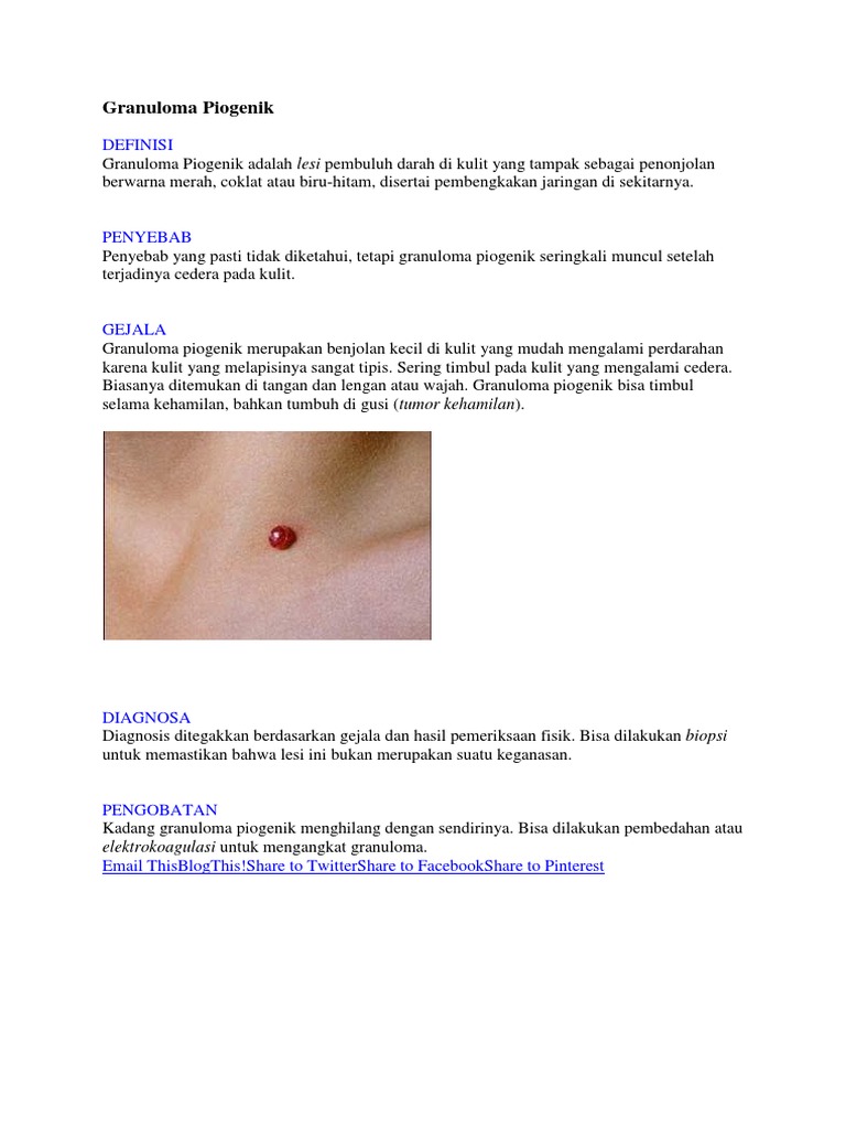 Granuloma Piogenik | PDF
