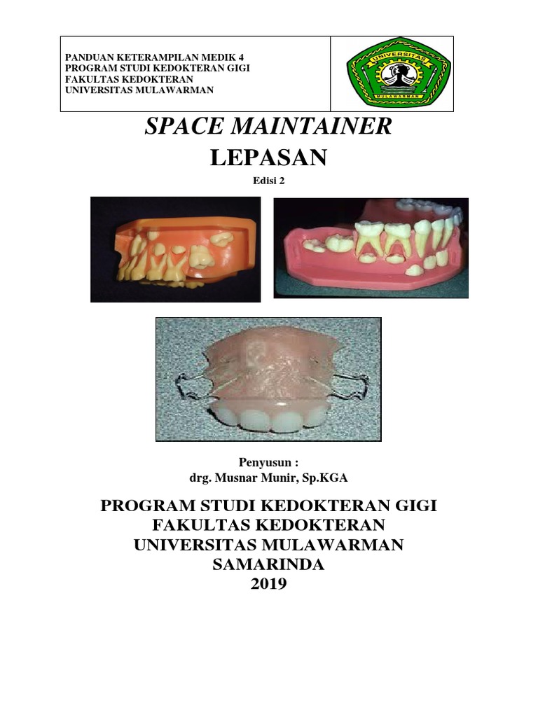 Panduan Trapmed Space Maintainer Edisi 2 | PDF