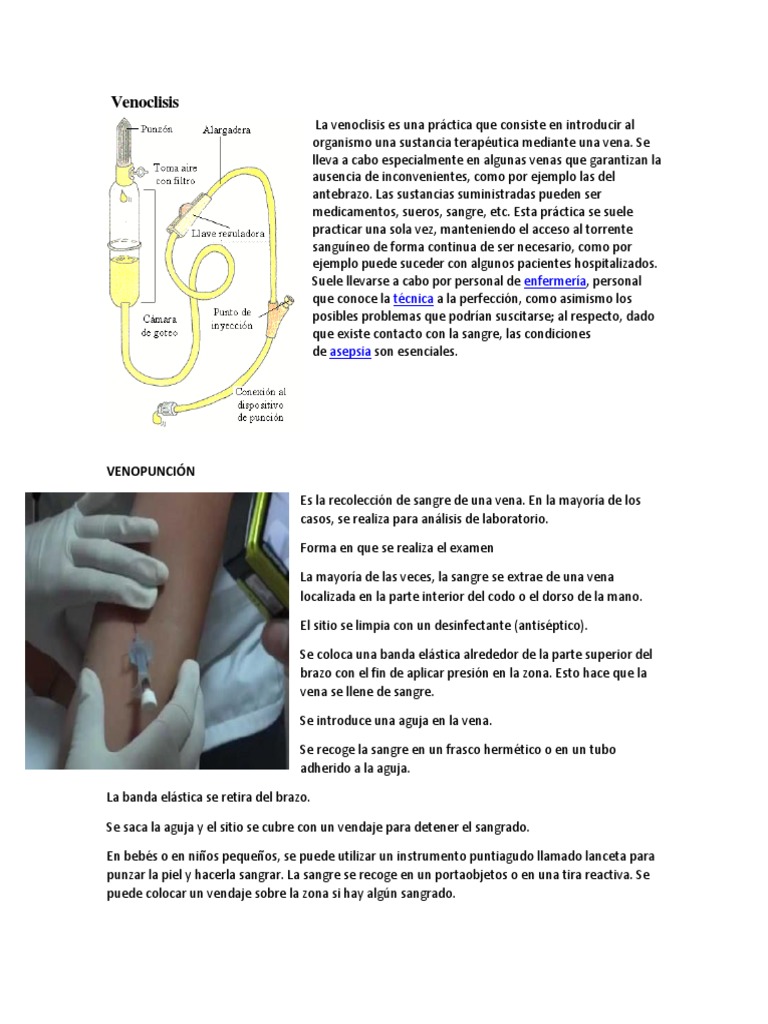 Venoclisis | PDF | Enfermedades y trastornos | Ciencias de la Salud