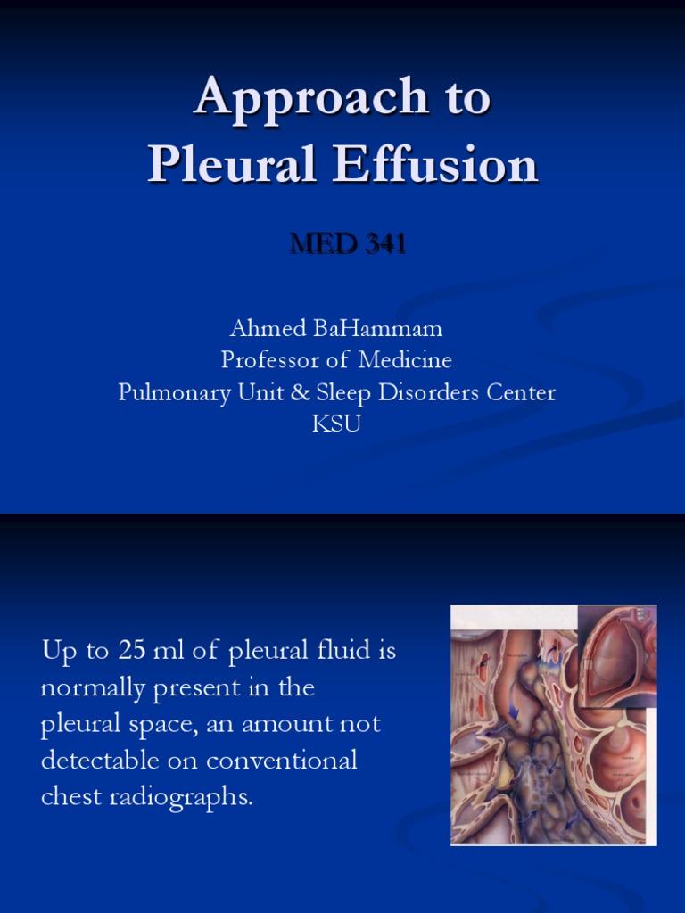 Approach To Pleural Effusion | PDF | Medical Specialties | Diseases And ...