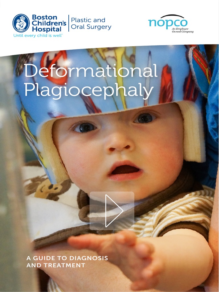 Deformational Plagiocephaly: A Guide To Diagnosis and Treatment | PDF | Congenital Disorder ...