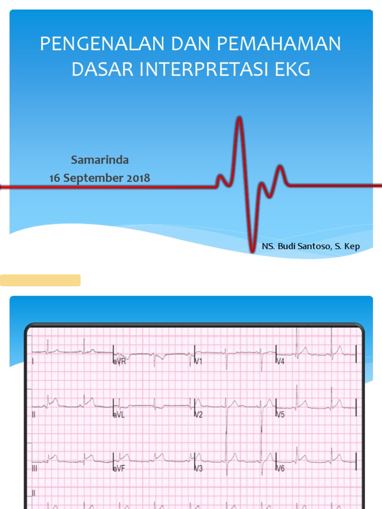 Dasar Interpretasi EKG untuk Pemula | PDF