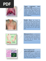 Fisher D4 Product Bulletin | PDF | Valve | Pounds Per Square Inch