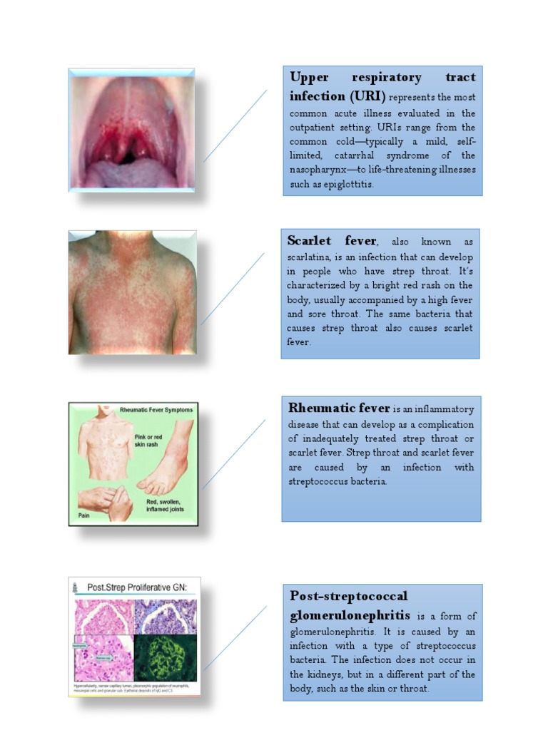 A Comprehensive Overview of Streptococcus pyogenes Infections: From ...